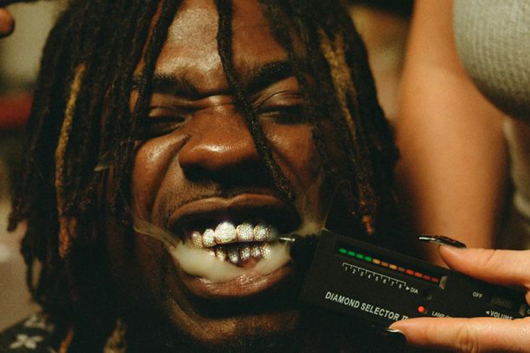 Le grillz, c'est le sourire d'enfer du rap français - RapCity